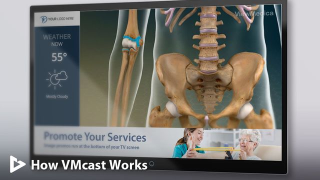 ViewMedica VMcast Rheumatology Patient Education Videos